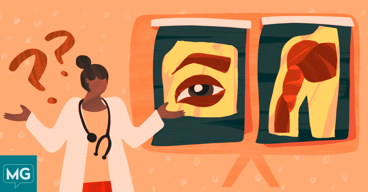 Why Is Myasthenia Gravis (MG) Difficult to Diagnose?