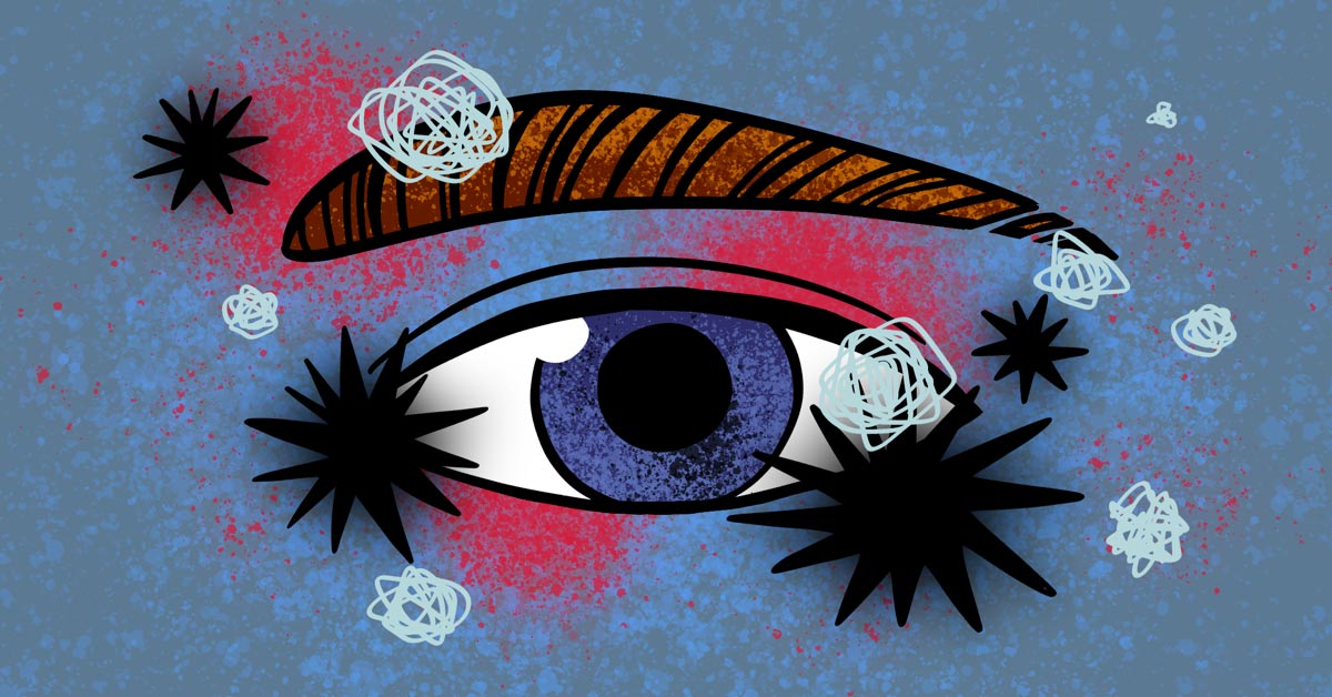 Can Ocular Myasthenia Gravis Progress to Generalized?